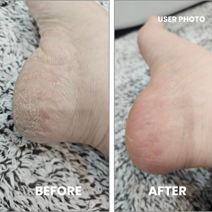 Sistaco Ergonomic Nanocrystal Foot Buffer